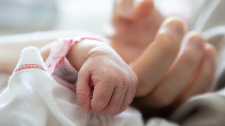 Sacral dimple: what it is and when to worry - Evidence Network